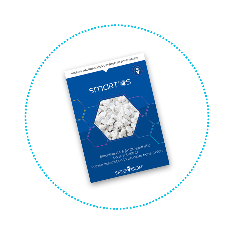 Smart’Os - SpineVision