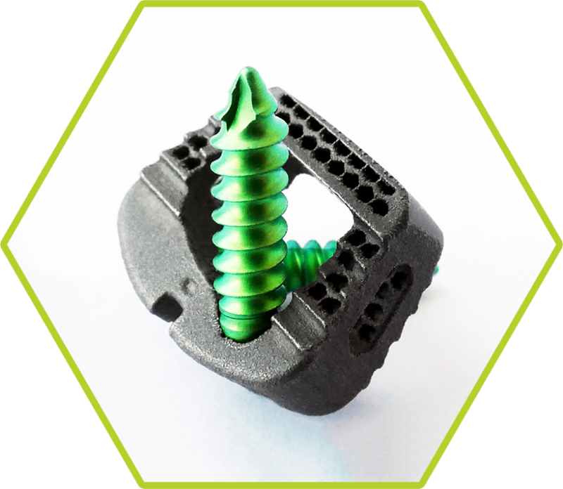 Our solutions - SpineVision